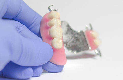 Affordable cobalt-chrome dentures - Dentures in Southampton